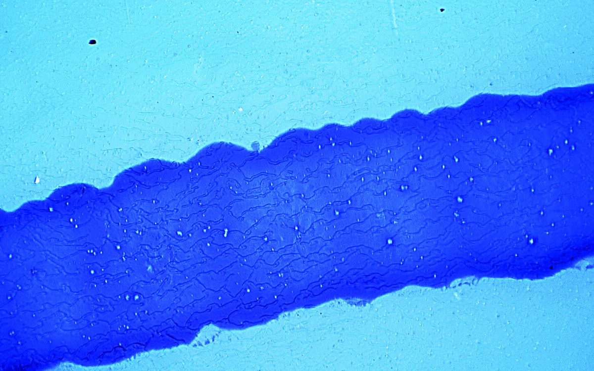 Polarized Microscope คืออะไร และหลักการทำงาน